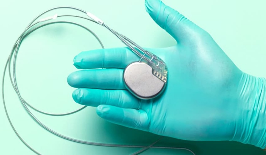 La UNLP desarrolla métodos para mejorar los marcapasos implantables